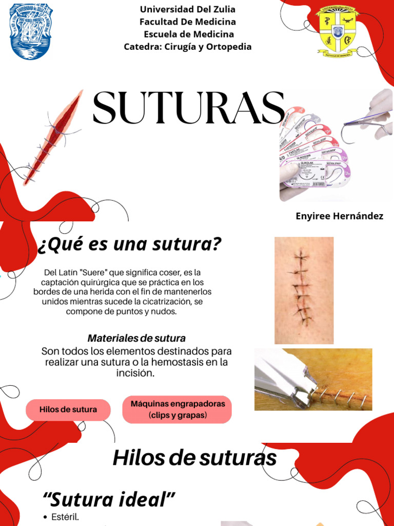 3-Nudos y Suturas | PDF | Sutura Quirúrgica