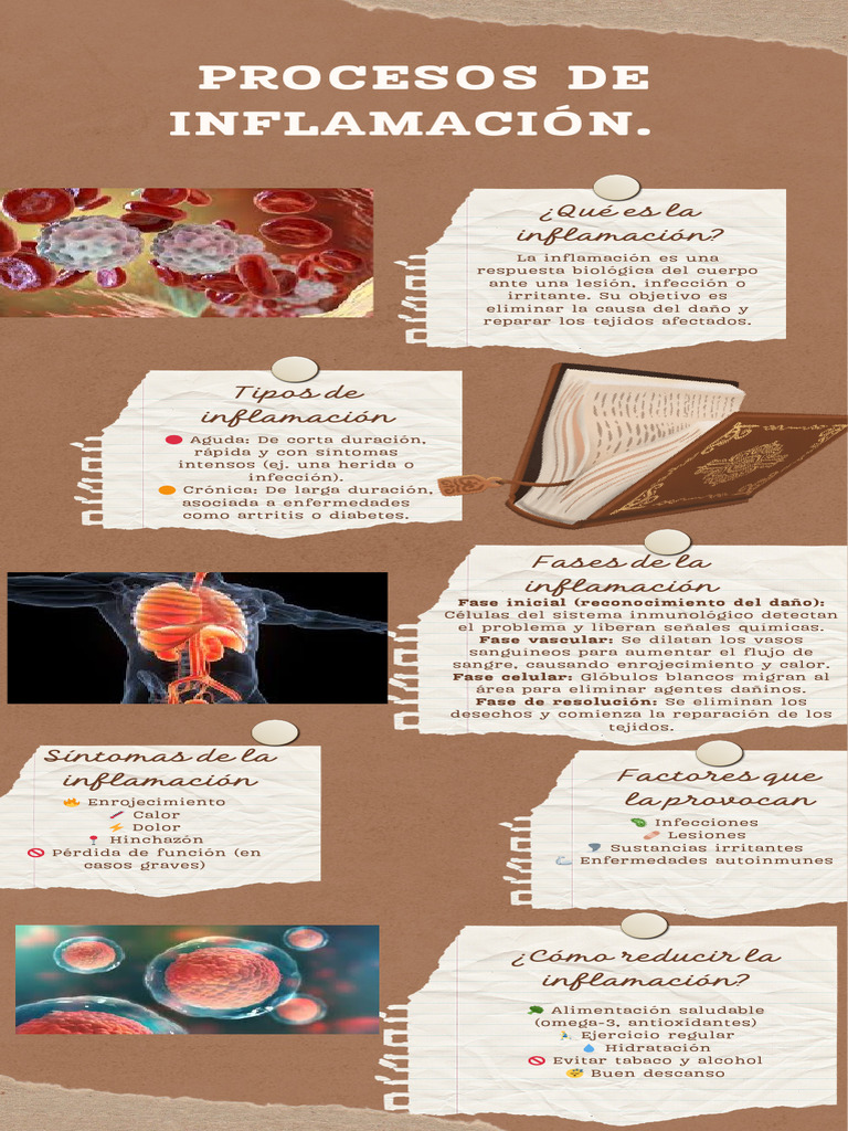 Infografía | PDF | Inflamación | Inmunología