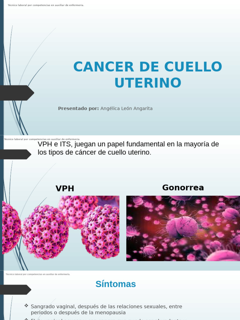 Cancer de Cuello Uterino | PDF | Cáncer de cuello uterino | Cáncer