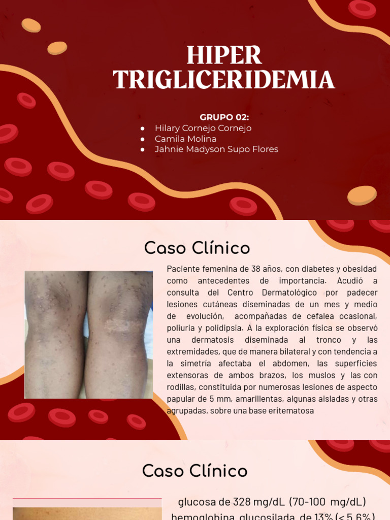 Hipertrigliceridemia - Caso Clínico | PDF | Diabetes | Trastornos del ...
