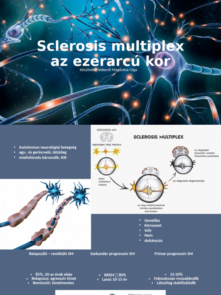 Sclerosis multiplex | PDF