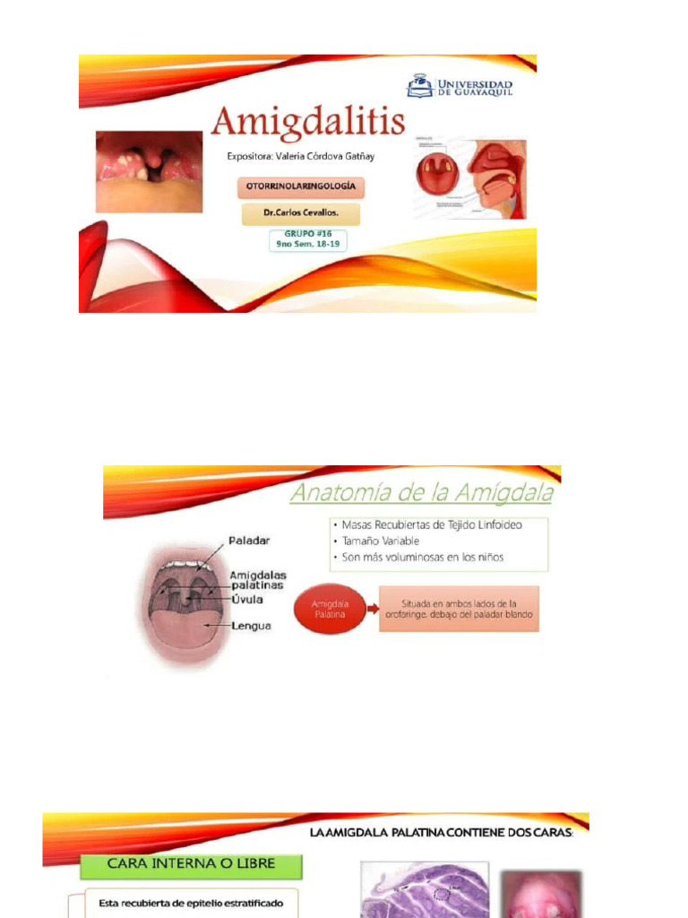 Amigdalitis Aguda | PDF