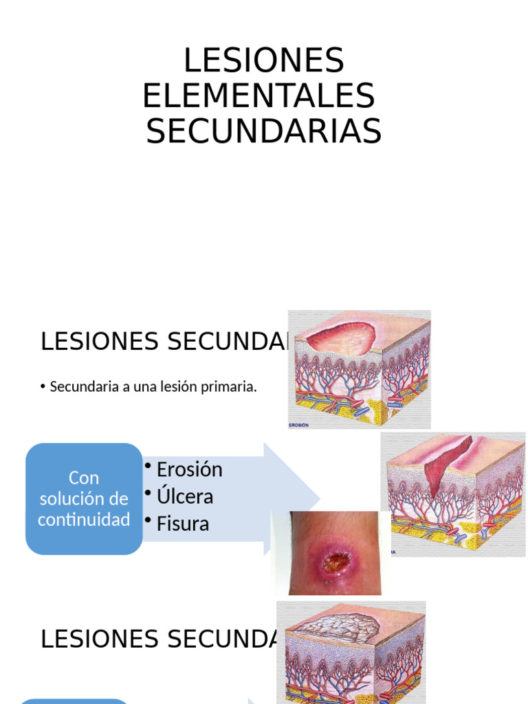 Lesiones Elementales Secundarias | PDF