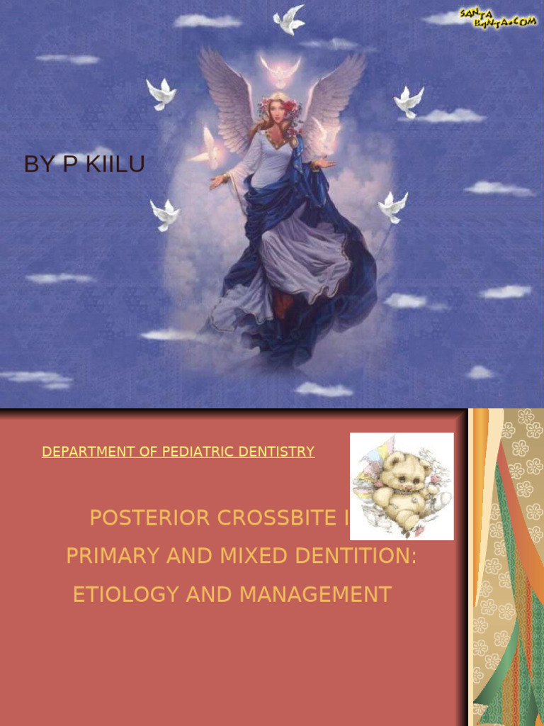 POSTERIOR CROSSBITE IN PRIMARY AND MIXED DENTITIOo | PDF | Dental ...