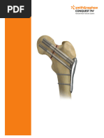 DHS DCS Hip System Surgical Technique (1) | PDF | Hip | Screw