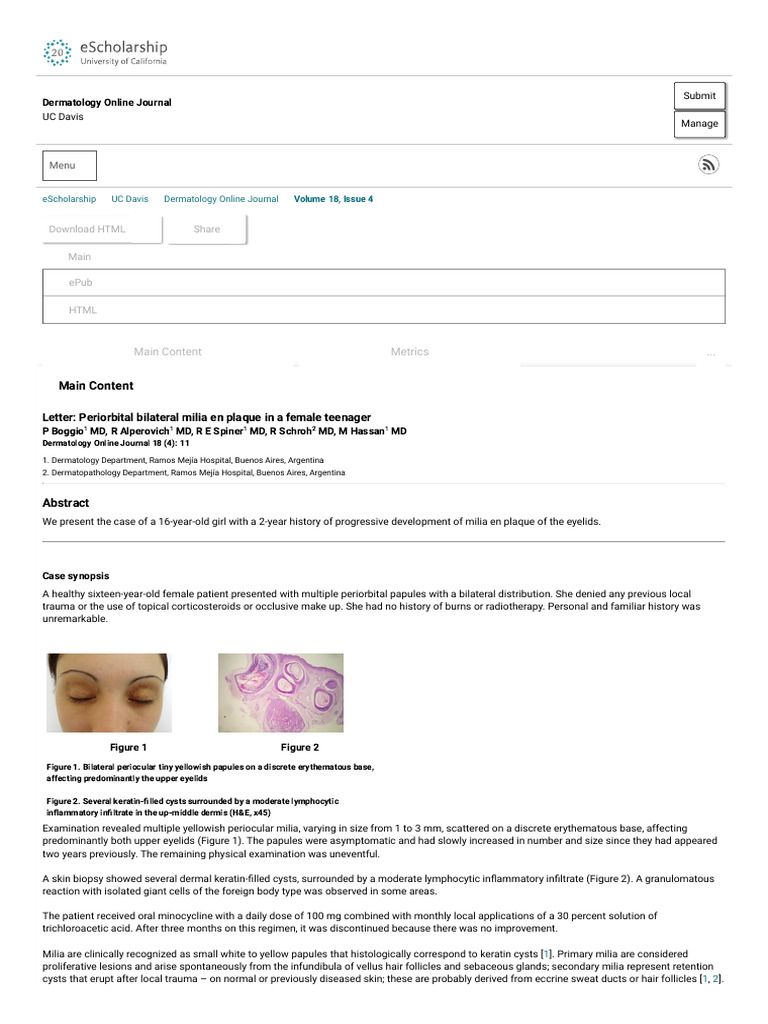 Periorbital bilateral milia en plaque in a female teenager | PDF ...
