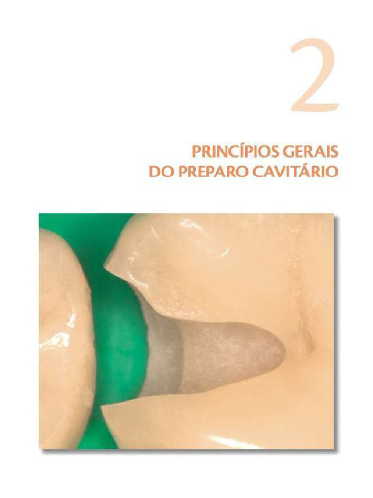 Prepario Cavitario I e II | PDF