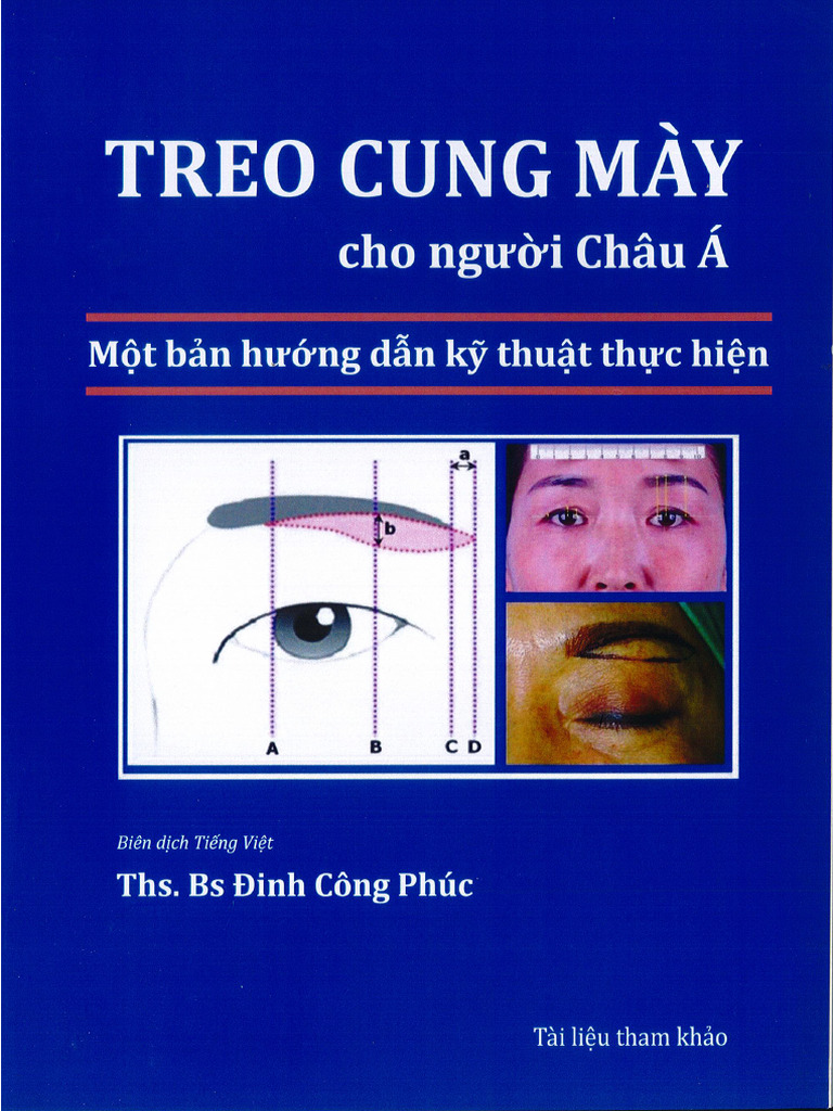 TRoe CNG Nau | PDF