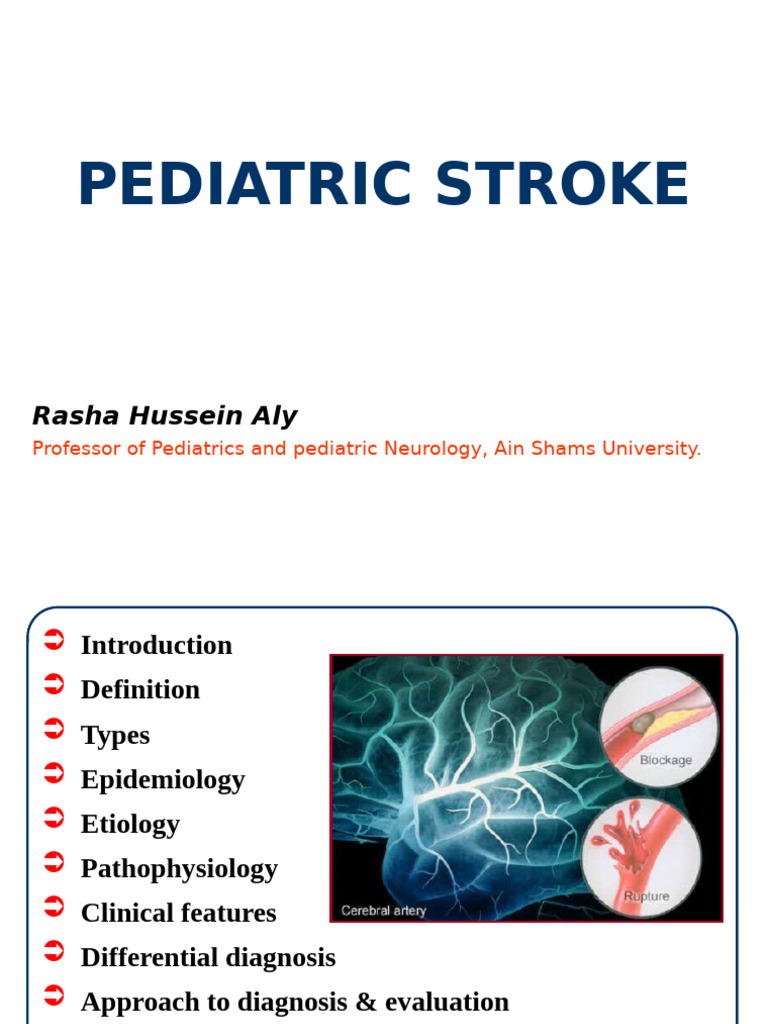 New Stroke | PDF | Stroke | Brainstem