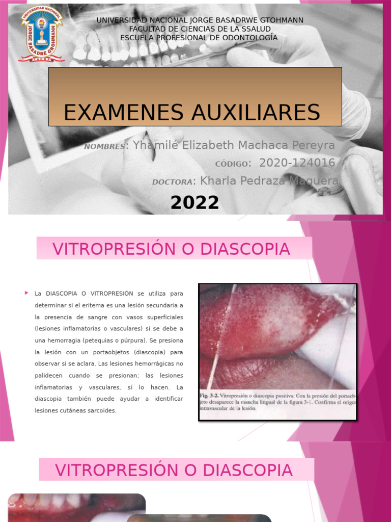 Examenes Auxiliares | PDF | Biopsia | Medicina