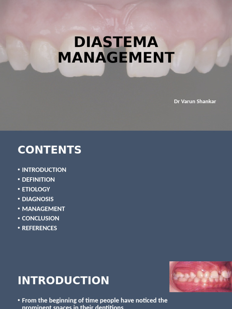 Managing Midline Diastema in Orthodontics | PDF | Orthodontics | Dental ...