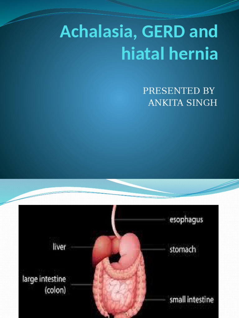 GERD, Achalasia, and Hiatal Hernia Overview | PDF | Gastroesophageal ...