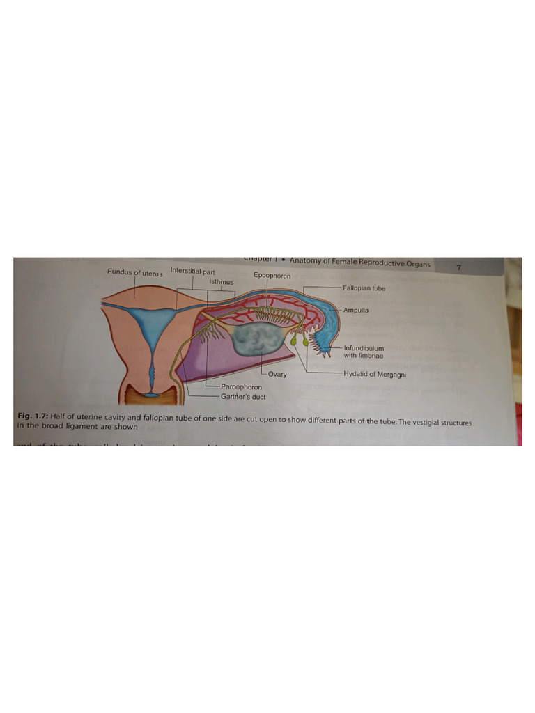 Uterine Cavity and Fallopian Tube | PDF