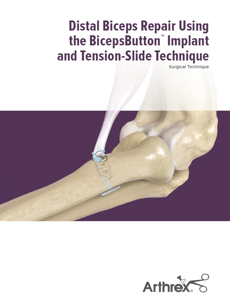 Distal Biceps Repair Using The Bicepsbutton and Tension Slide Technique | PDF | Surgical Suture ...