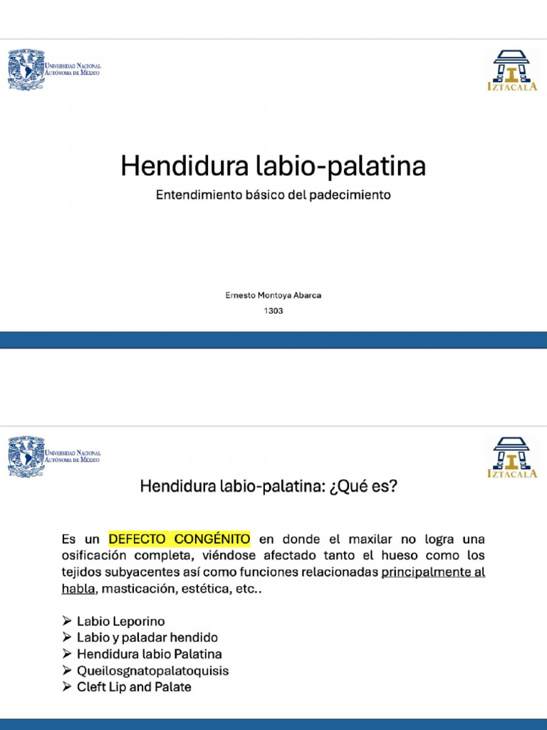 Hendidura Labio Palatina | PDF