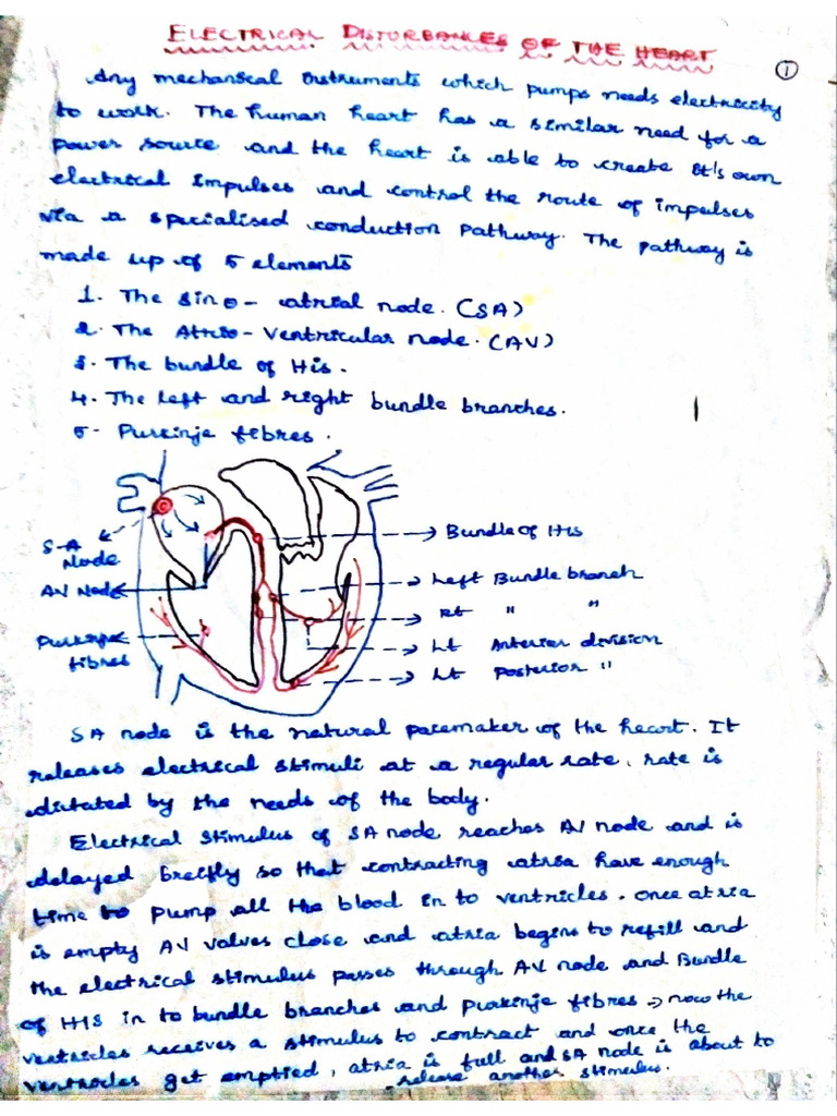 Electrical Disturbance of Heart | PDF
