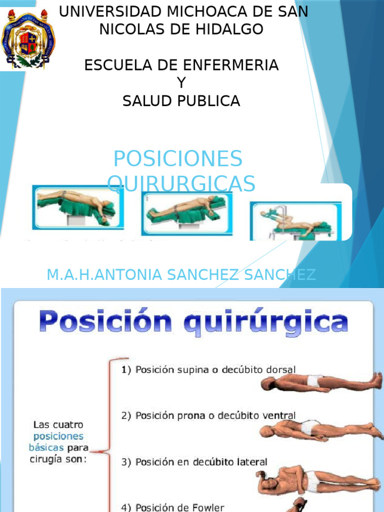 Posiciones Quirurgicas para Cirugia | PDF | Abdomen | Tórax