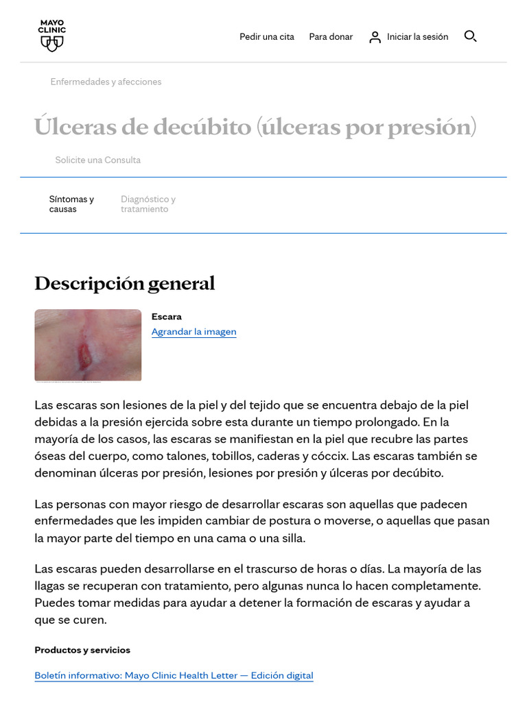 Úlceras de decúbito (úlceras por presión) - Síntomas y causas - Mayo ...