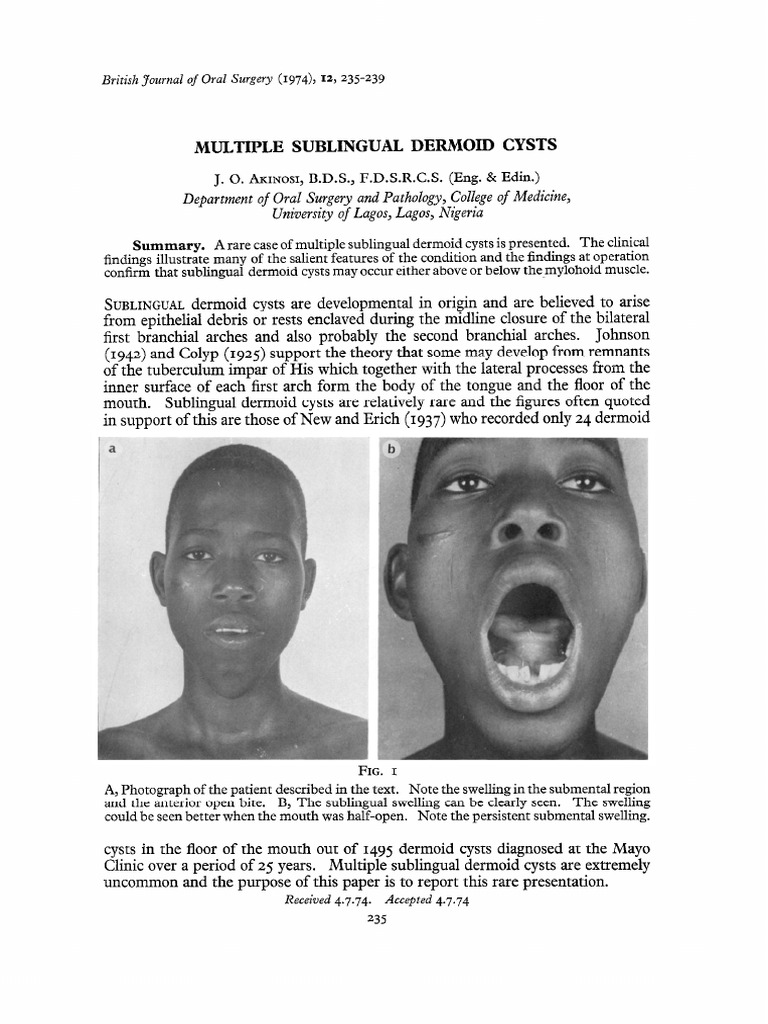 MULTIPLE SUBLINGUAL DERMOID CYSTS | PDF | Tongue | Medical Specialties