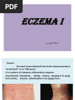 Hanifin-Rajka Criteria for Atopic Dermatitis | PDF | Immune System ...