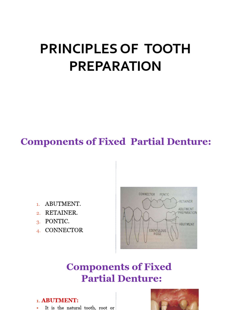 Principles of Tooth Preparation Compressed 1 | PDF | Dentistry Branches ...