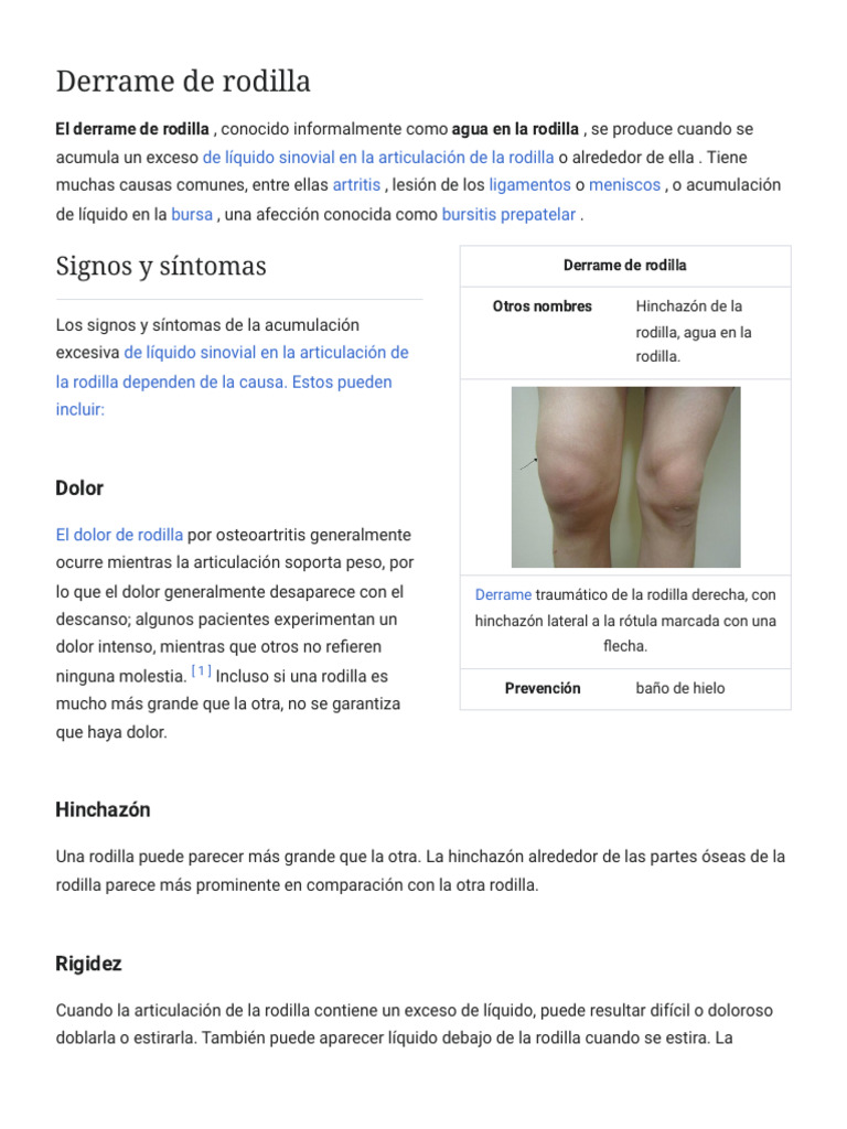 Derrame de líquido sinovial en rodilla | PDF | Rodilla | Enfermedades y ...