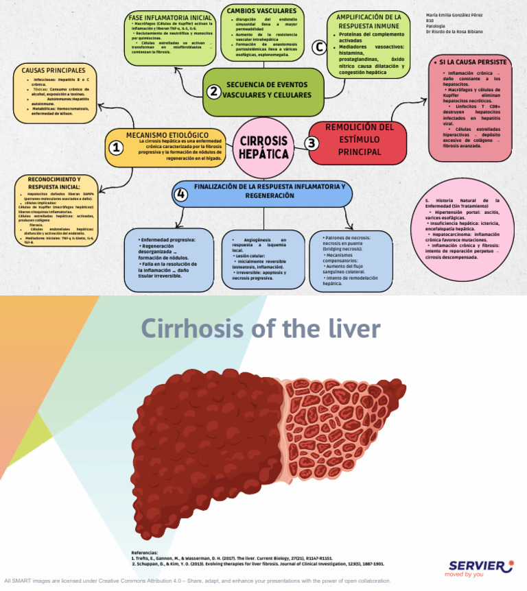 Esquema cirrosis hepática | PDF | Inflamación | Especialidades Medicas