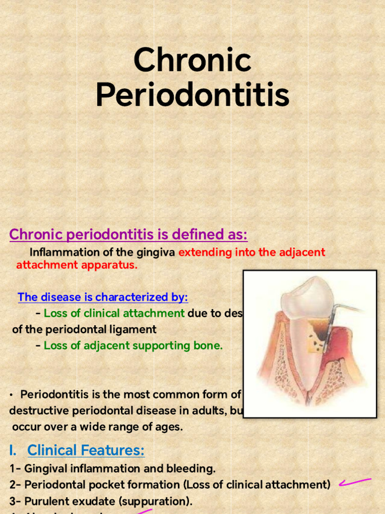 Chronic Periodontitis - 9 | PDF | Periodontology | Human Tooth