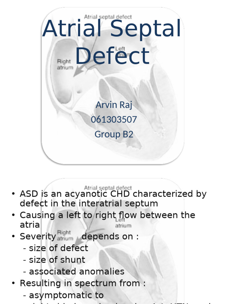 Atrial Septal Defect | PDF | Circulatory System | Diseases And Disorders