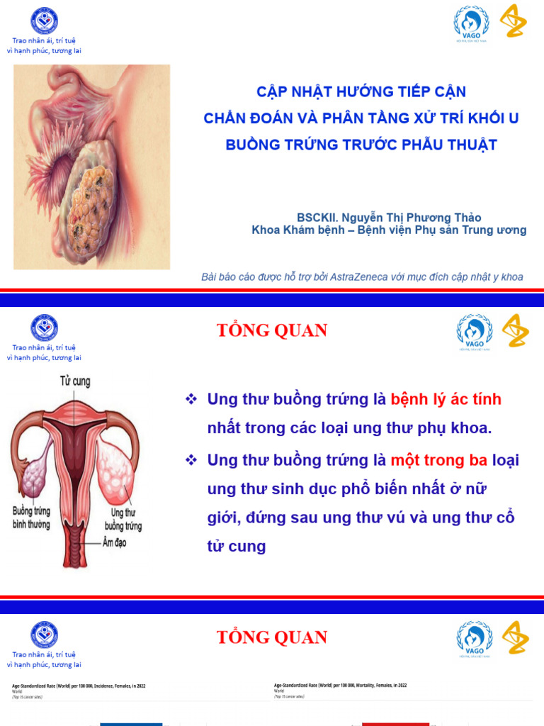 Chẩn Đoán U Bu NG TR NG | PDF