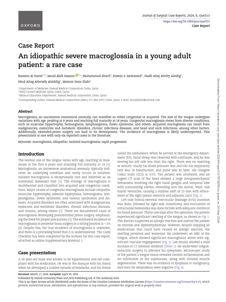 Macroglossia Case Report | PDF | Medicine | Clinical Medicine