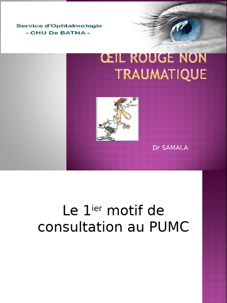 (C3) - Oeil Rouge | PDF | Glaucome | Ophtalmologie