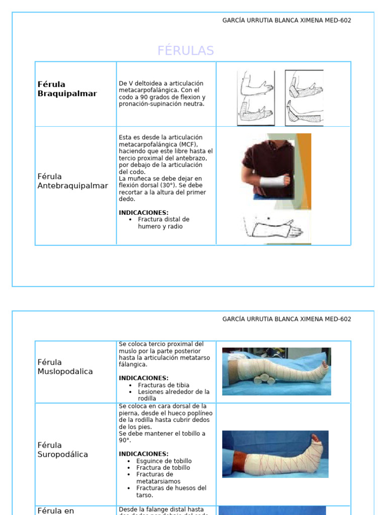 Tipos de férulas y sus indicaciones | PDF | Codo | Tobillo