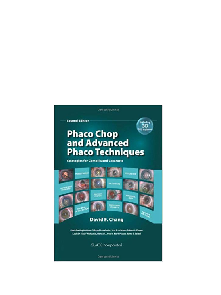 Advanced Phaco Techniques for Cataracts | PDF | Ophthalmology | Human Eye