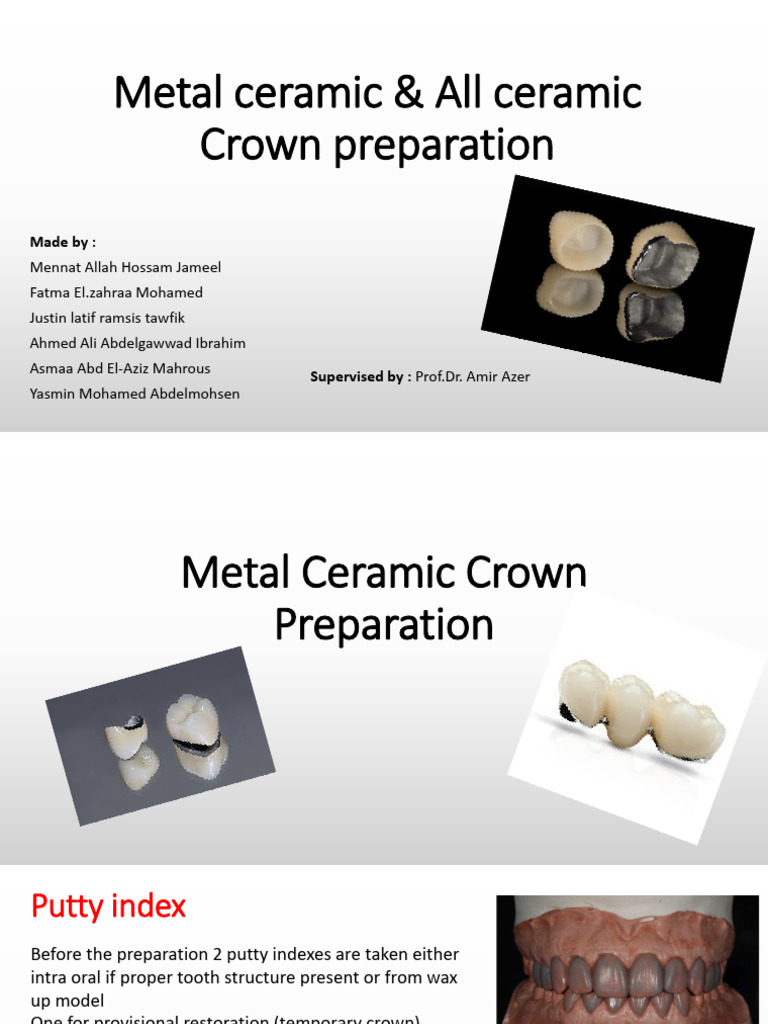 PFM vs All-Ceramic Crown Preparation | PDF | Dentistry Branches | Materials