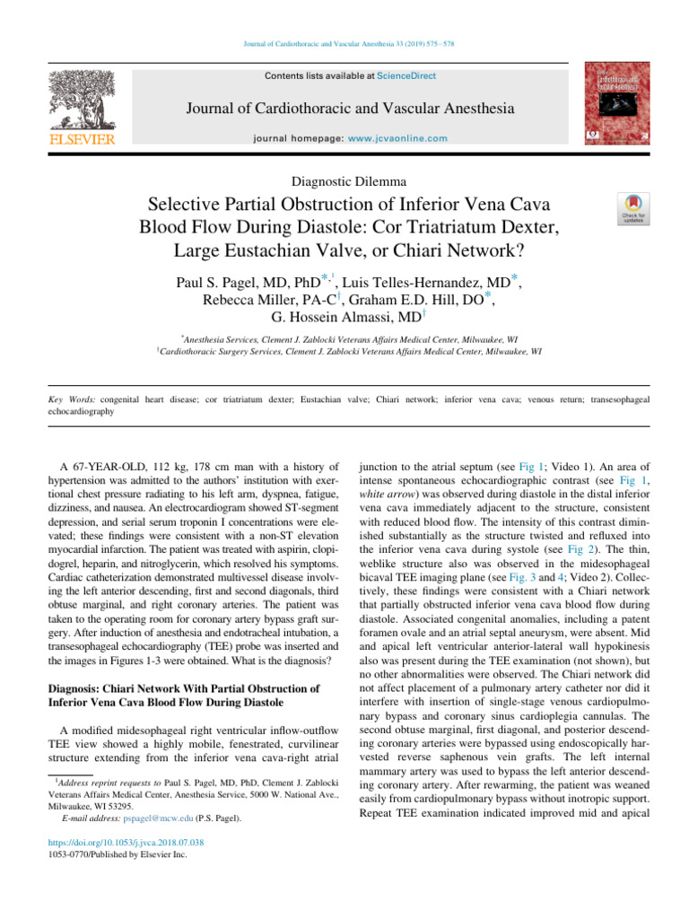 Selective-Partial-Obstruction-of-Inferior-Vena-Cav | PDF | Vein | Heart
