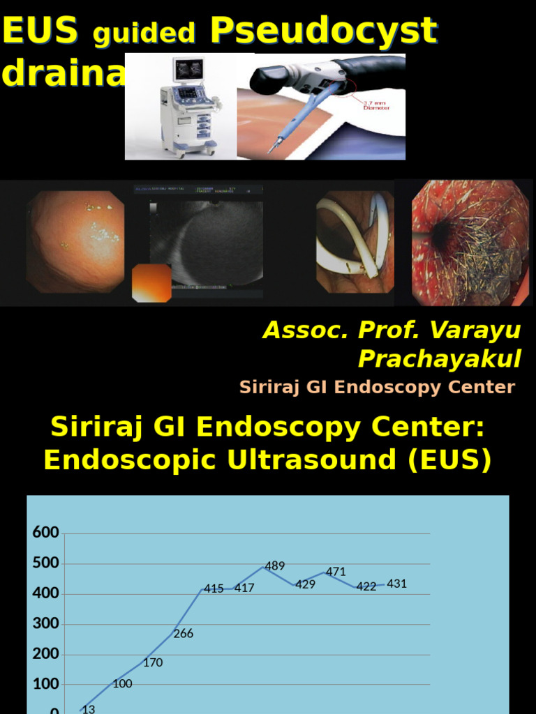 3. EUS-guided Pancreatic Pseudocyst Drainage | PDF | Exocrine System ...
