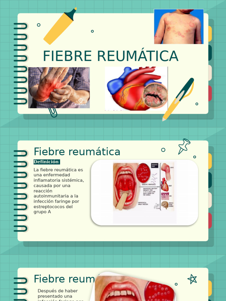 Fiebre Reumática Expo | PDF | Insuficiencia cardíaca | Sistema ...