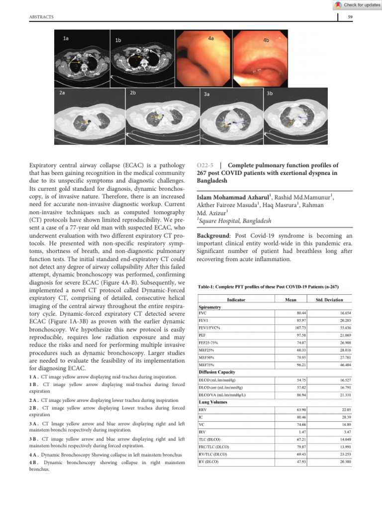 Respirology - 2021 - O22 5 Complete Pulmonary Function Profiles of 267 Post COVID Patients With ...