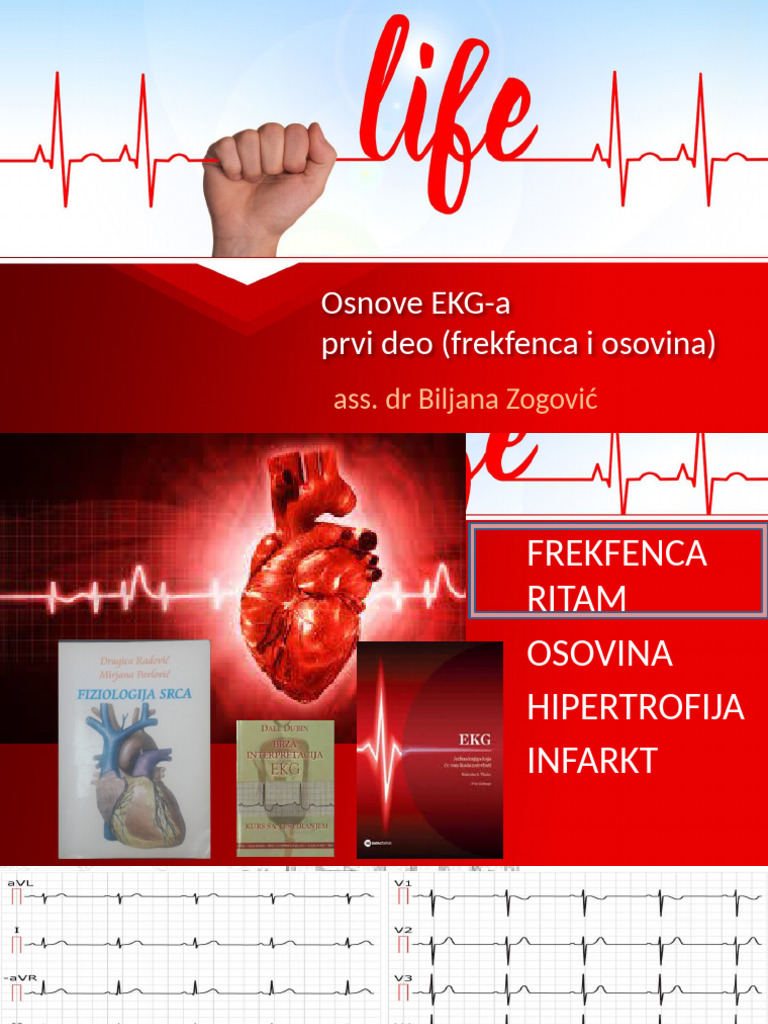Ekg 1 | PDF