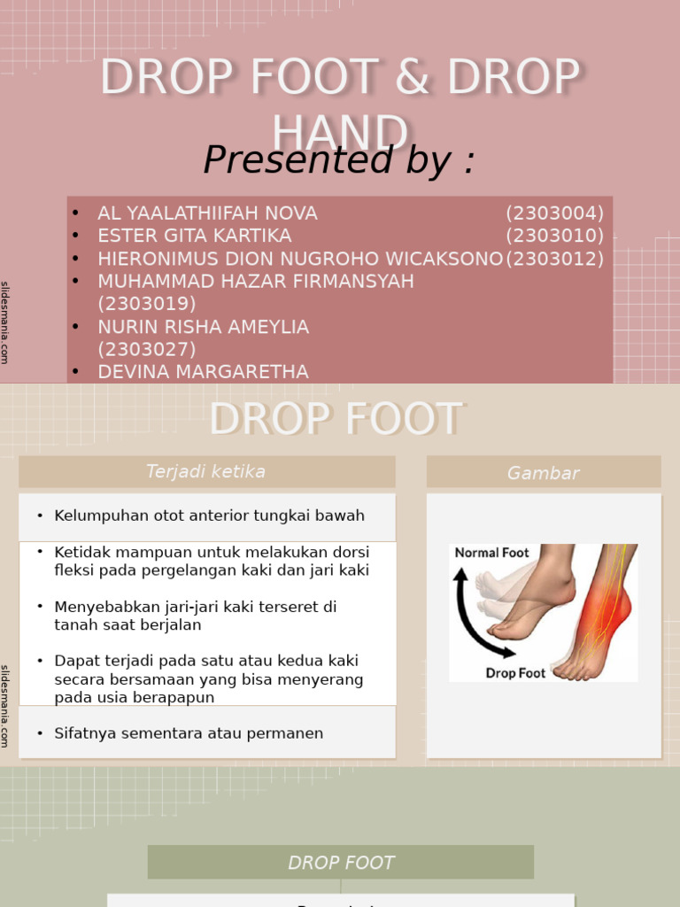 Drop Foot and Hand | PDF