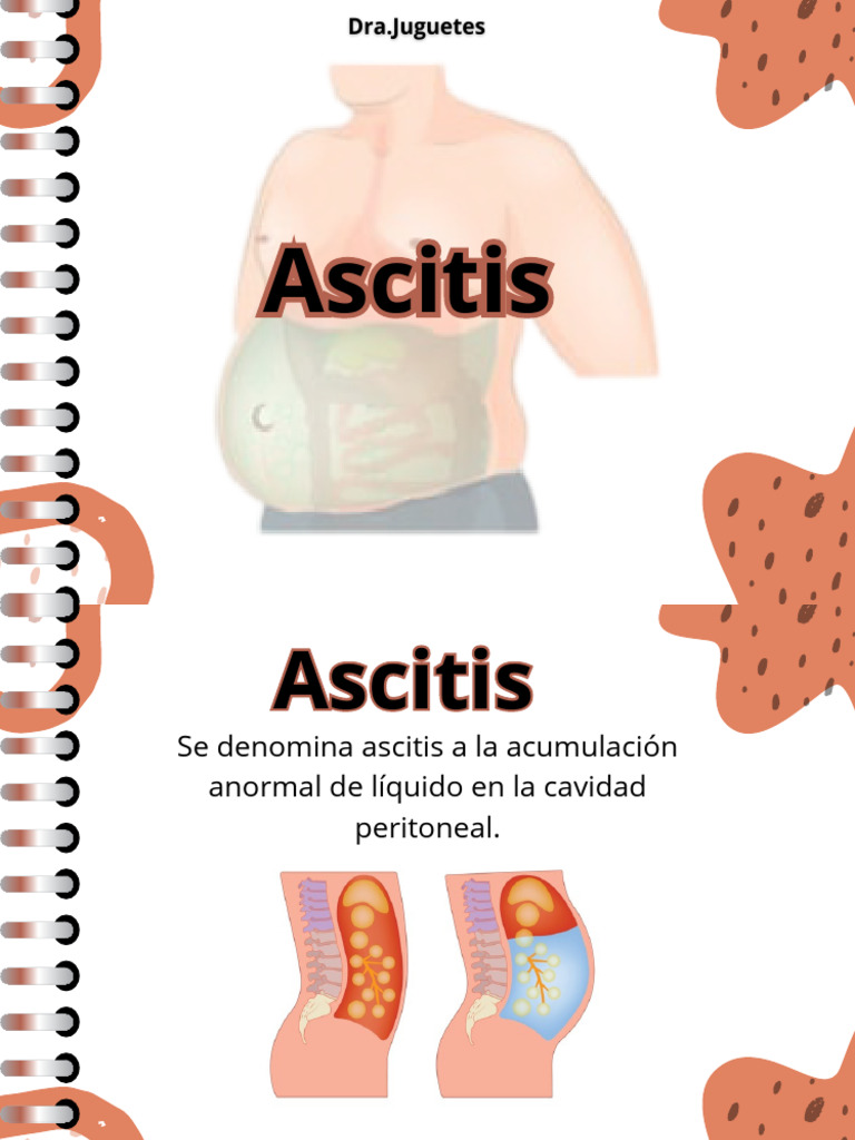 Causas y diagnóstico de ascitis | PDF