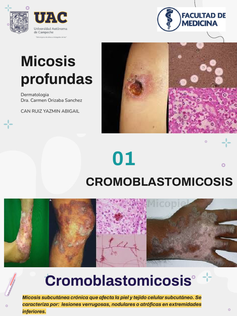 Presentación - MICOSIS PROFUNDAS | PDF | Medicina | Enfermedades y ...