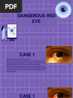 Lid Parallel Conjunctival Folds (LIPCOF) | PDF | Optics | Ophthalmology