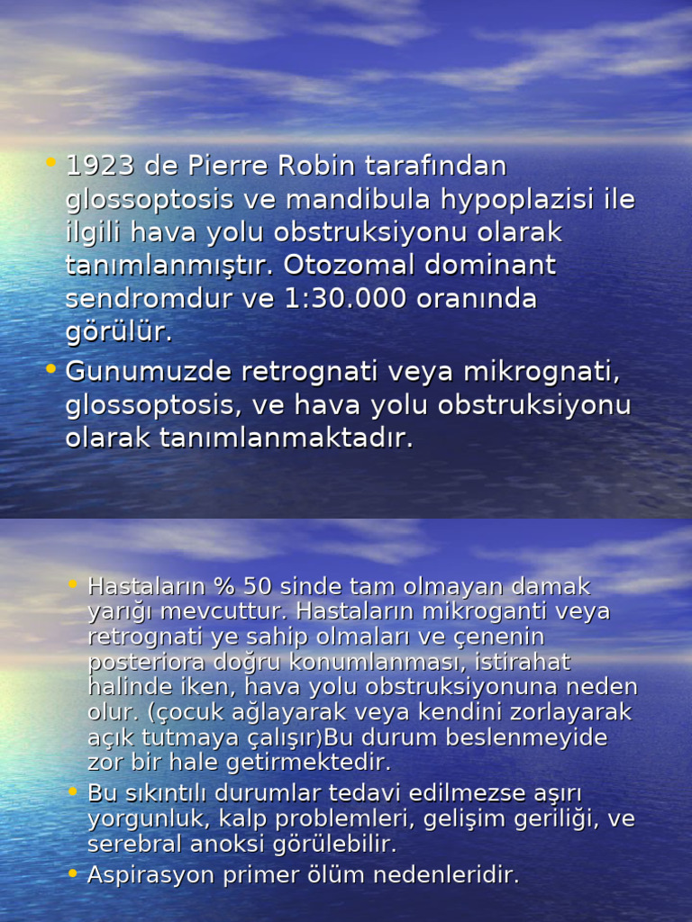 Pierre Robin Syndrome | PDF
