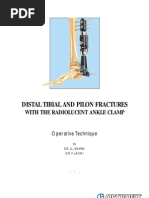 Articular Step-Off and Osteoarthritis Risk | PDF | Osteoarthritis | Knee