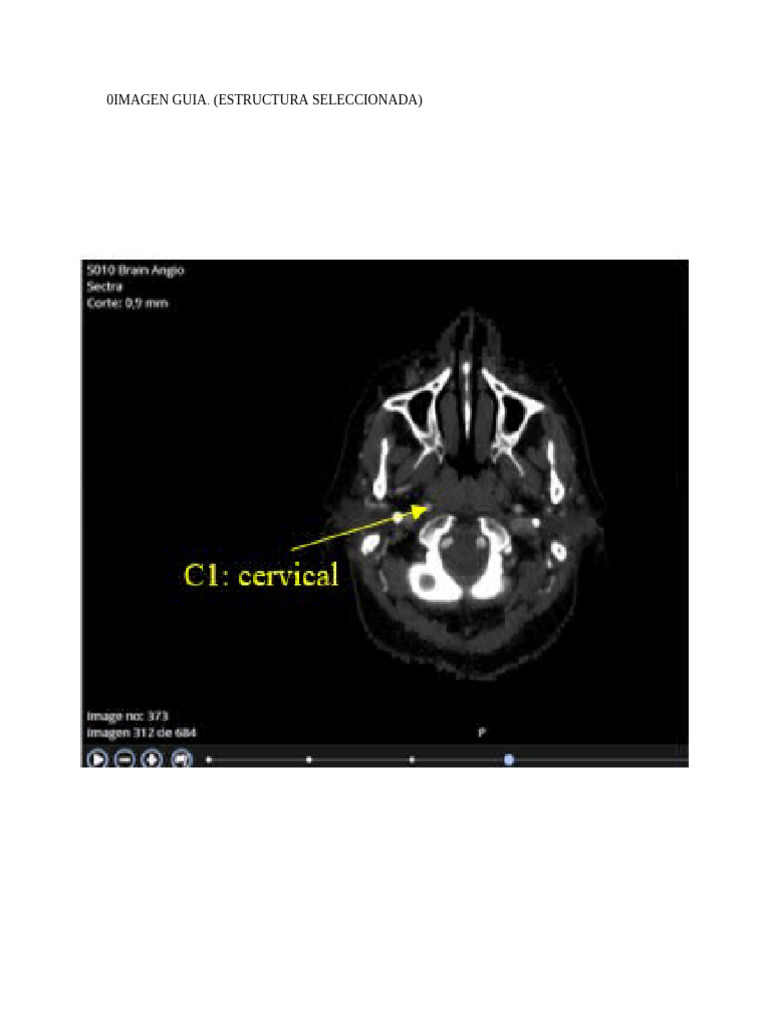 C1 Cervical Structure Guide | PDF