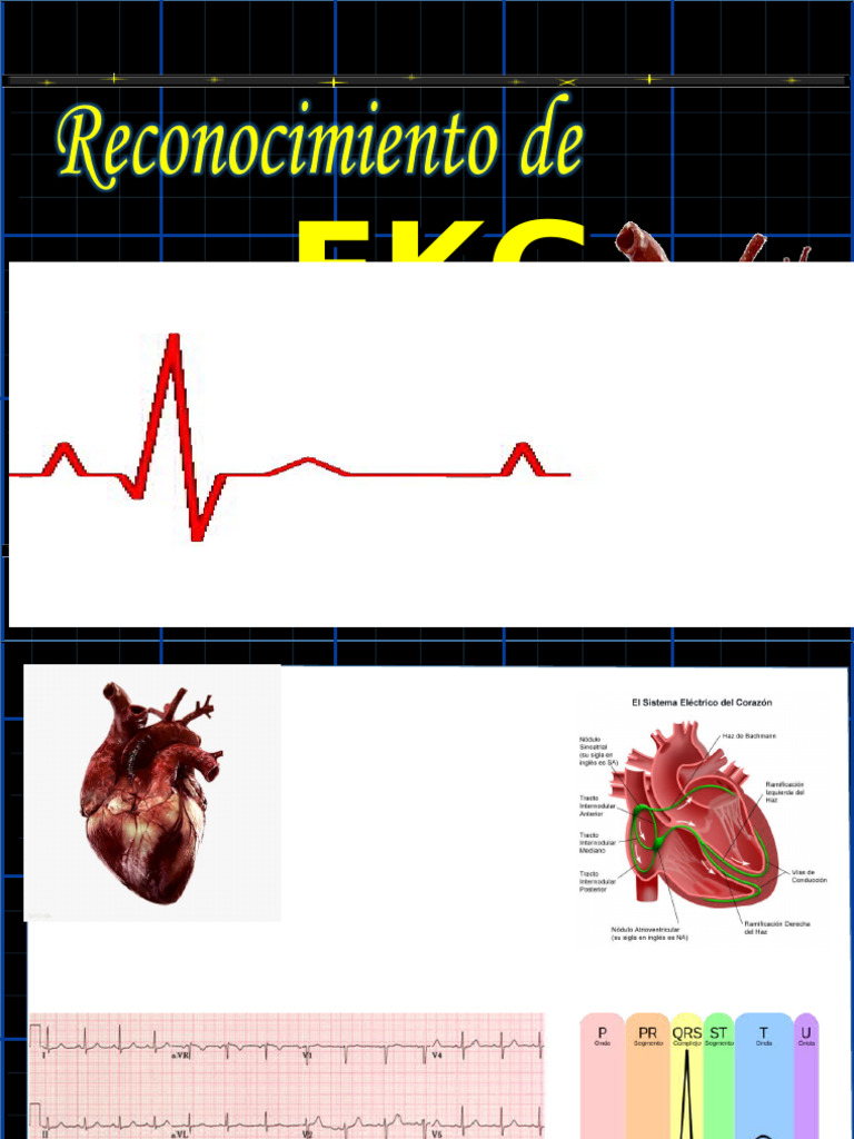 Ekg Basico - Super Rapida - 14122024 | PDF | Enfermedades cardiovasculares | Arritmia cardiaca