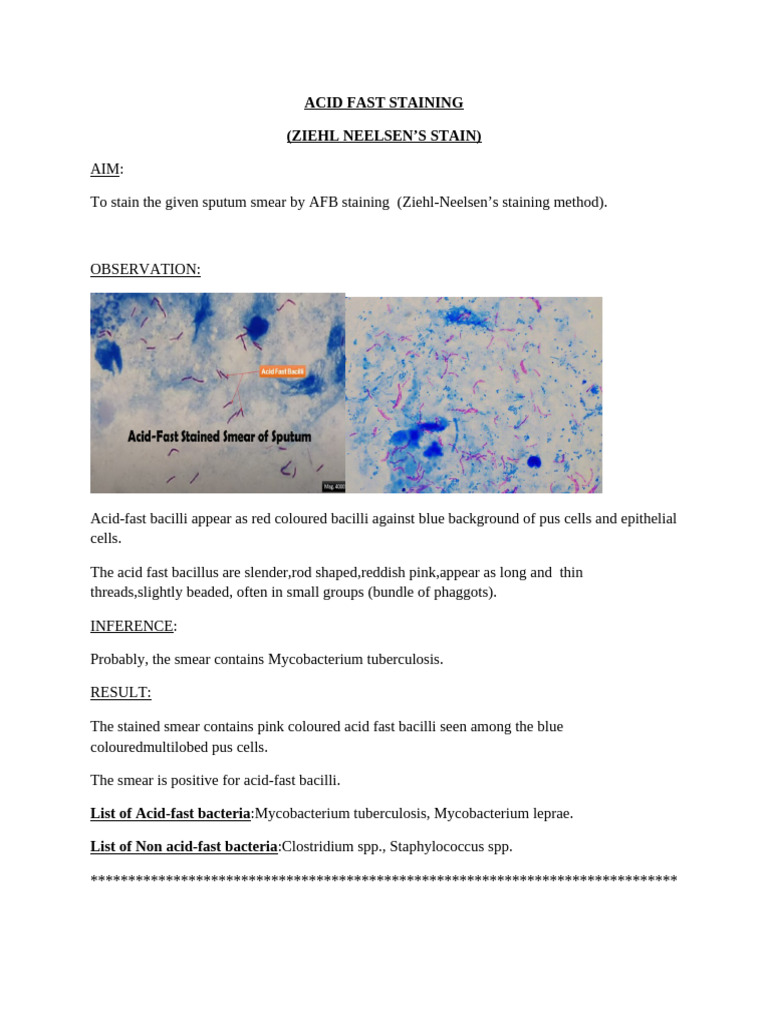 ACID FAST STAINING-for Writing in Practical Exam | PDF