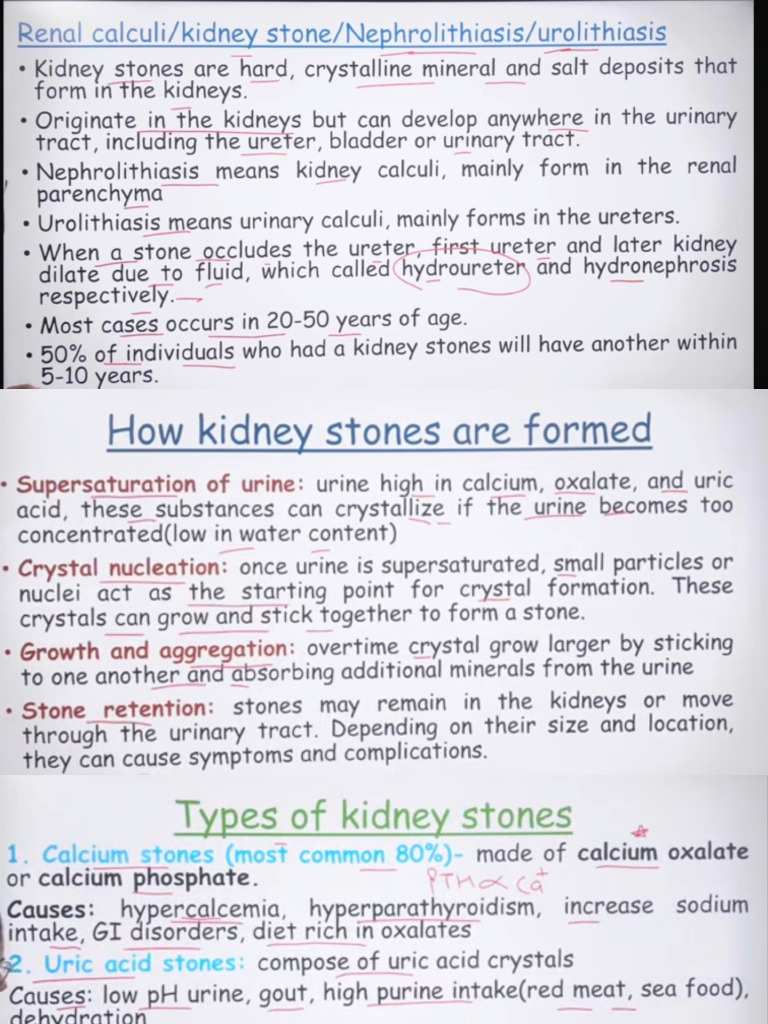 Kidney Stone | PDF